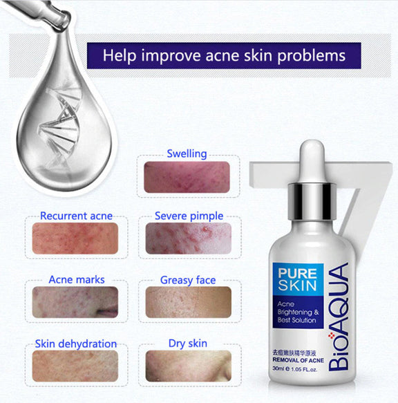 BIOAQUA Skin Care Acne Face Treatment 3 in 1 Acne Series (With Free Sh ...